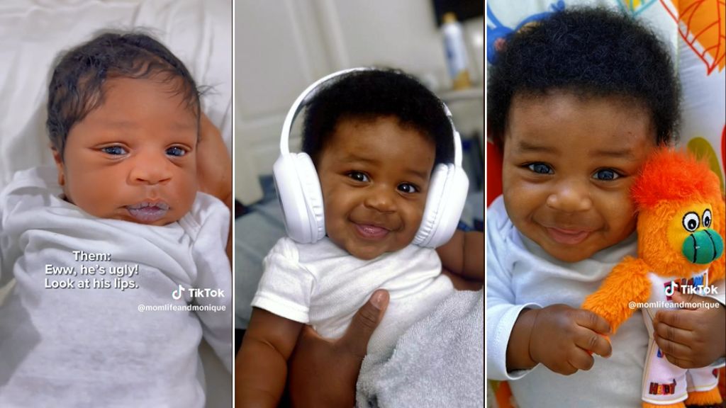 "They said he's ugly because of his lips" - Mother shows amazing ...