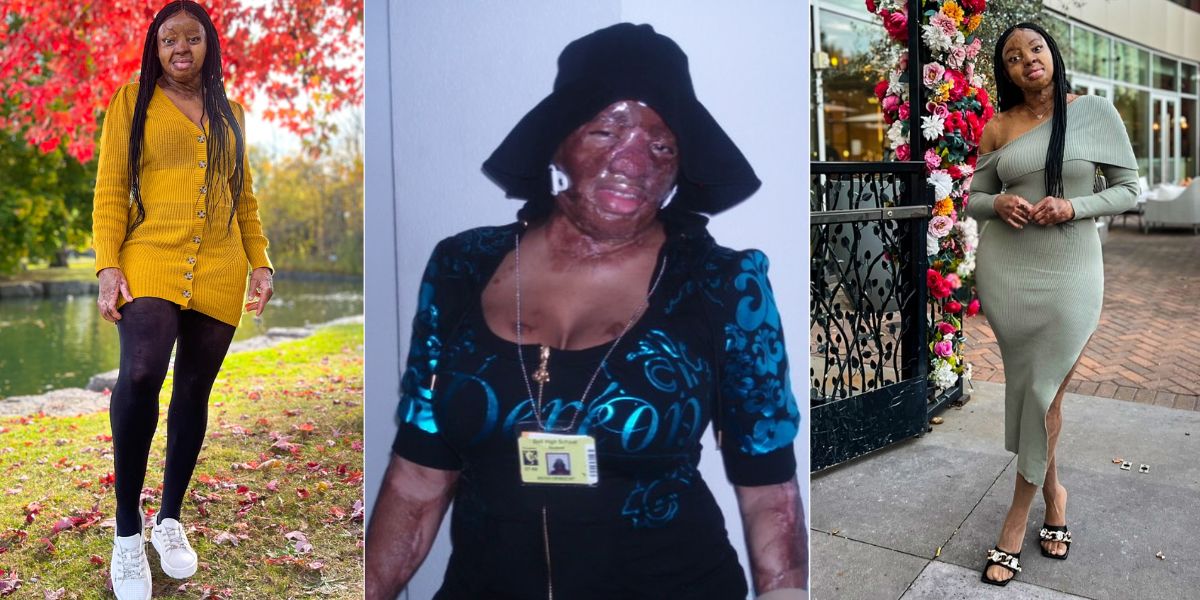 "I've come such a long way" - Sosoliso crash survivor Kechi Okwuchi ...