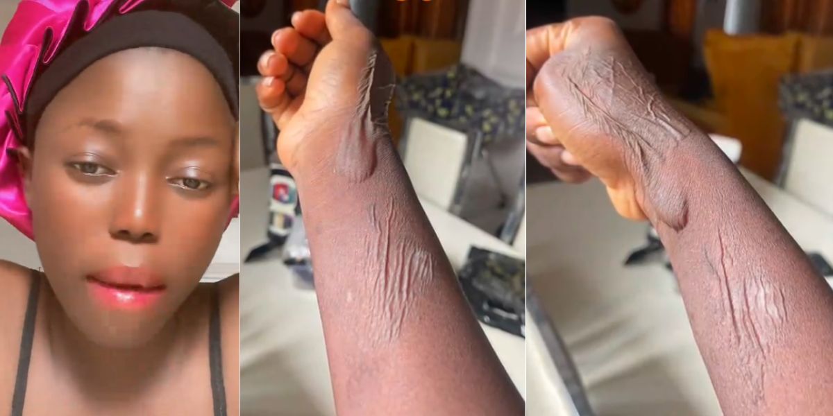 Nigerian lady cries out as she wakes up with strange marks on hand ...